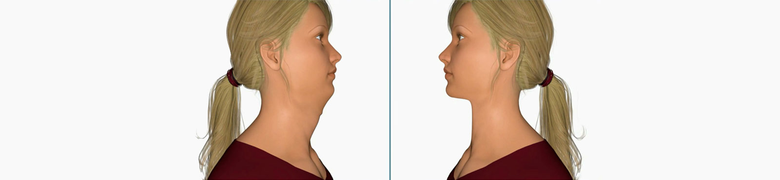 Elastic Plastic Surgery | Korpo.com