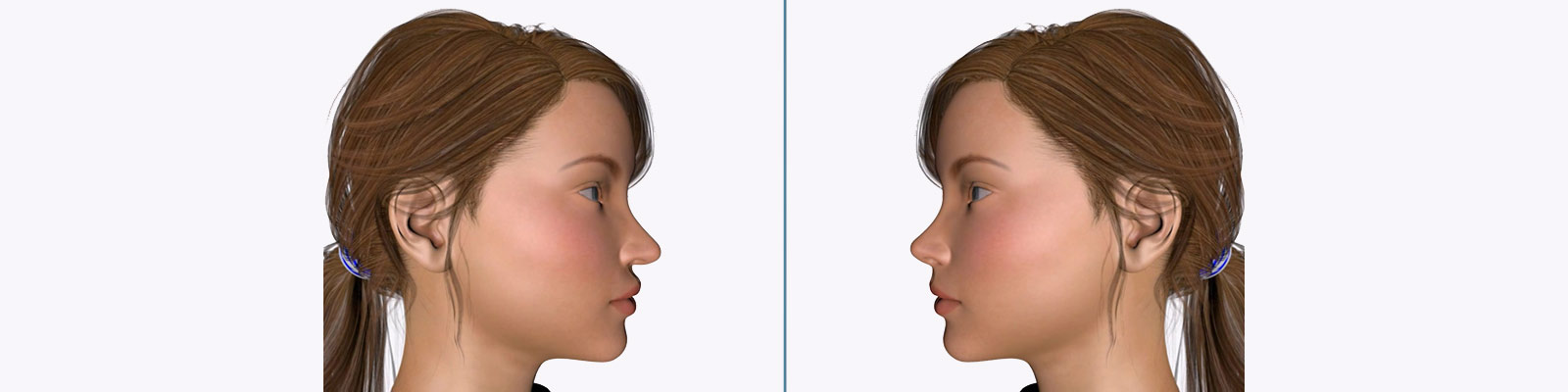 Elastic Plastic Surgery | Korpo.com