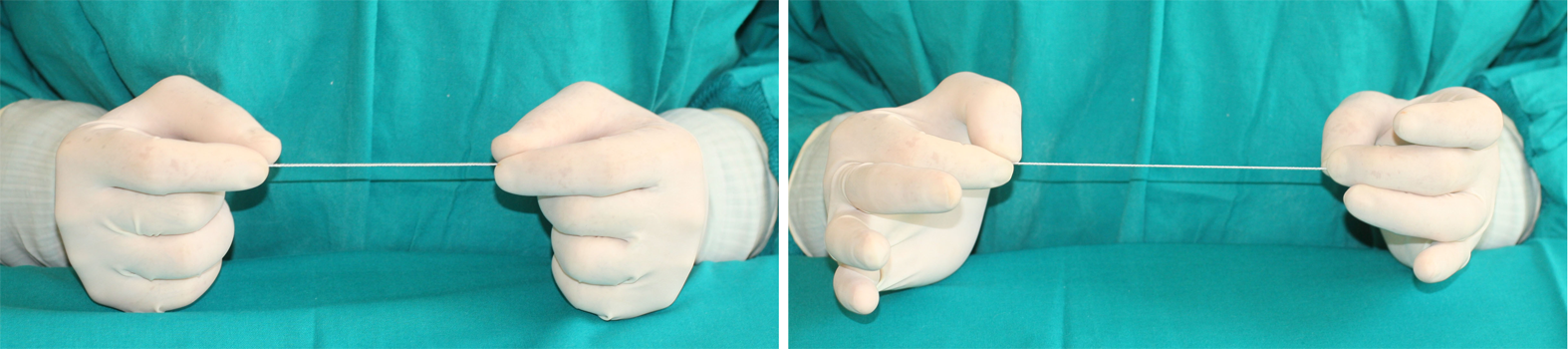 Elasticum suture® - Elastic Surgical Suture | Korpo.com