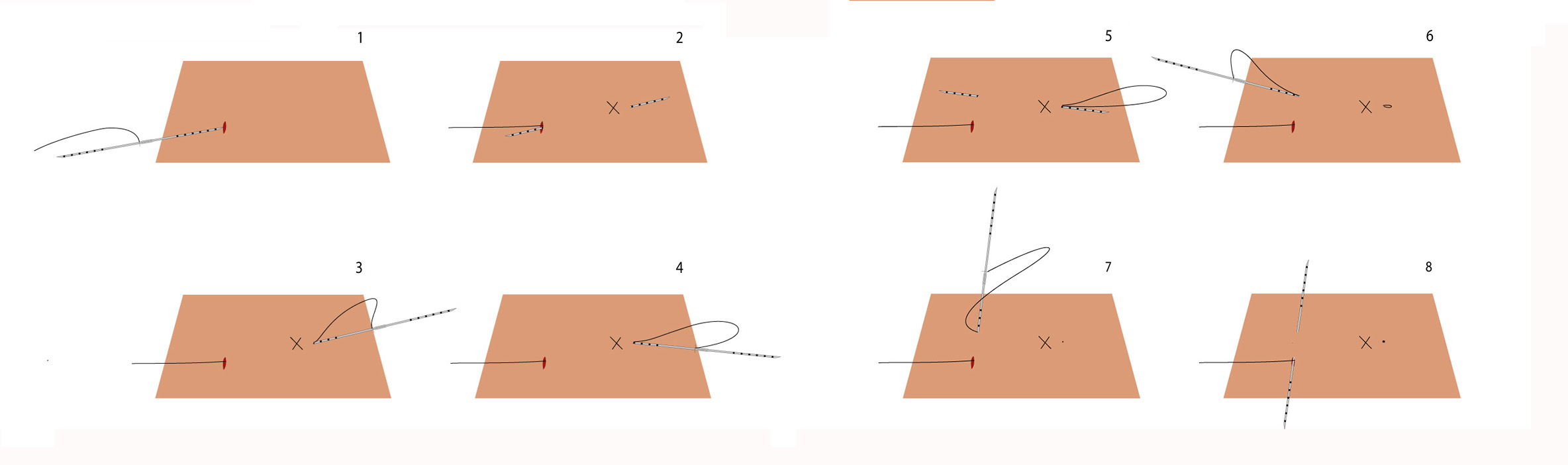 Elastic Plastic Surgery - Come funziona | Korpo.com