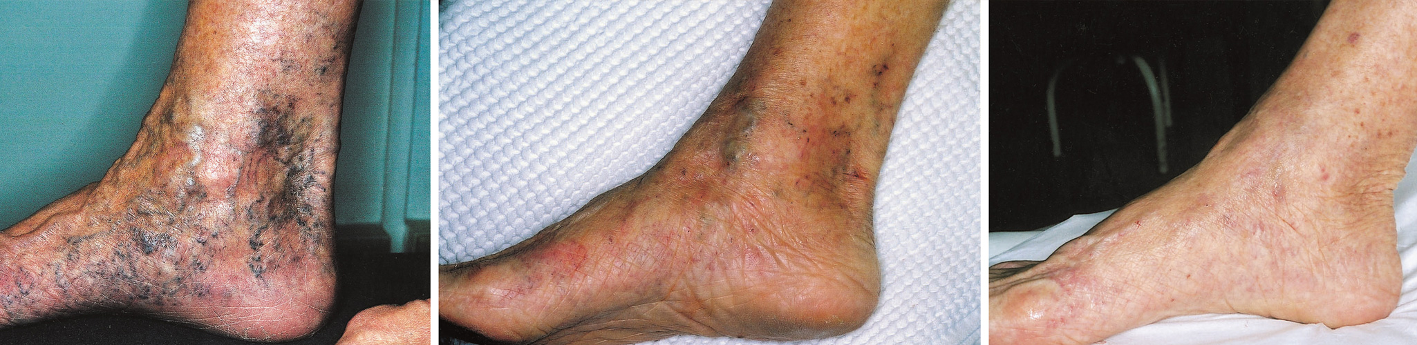 Phlebology - Key Concepts | Korpo.com