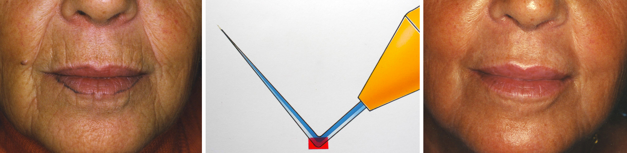 Timed Surgery Procedure | Korpo.com